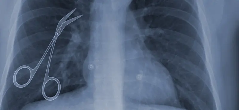 What Is Considered Medical Malpractice